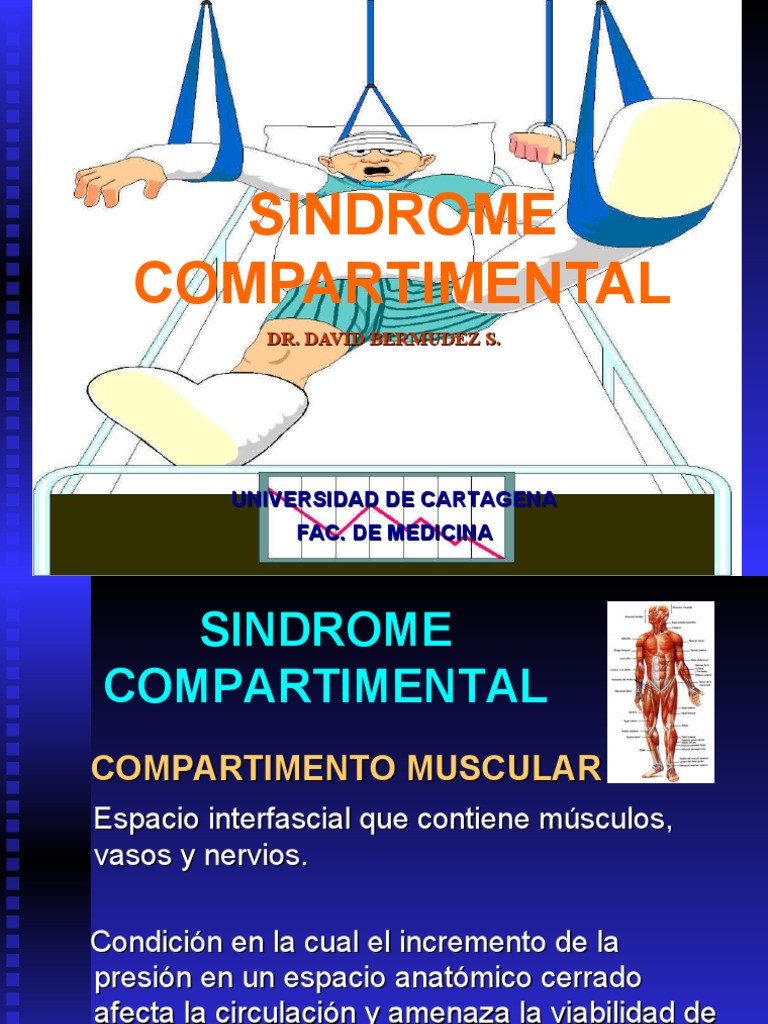 Sindrome Compartimental Nuevas | PDF