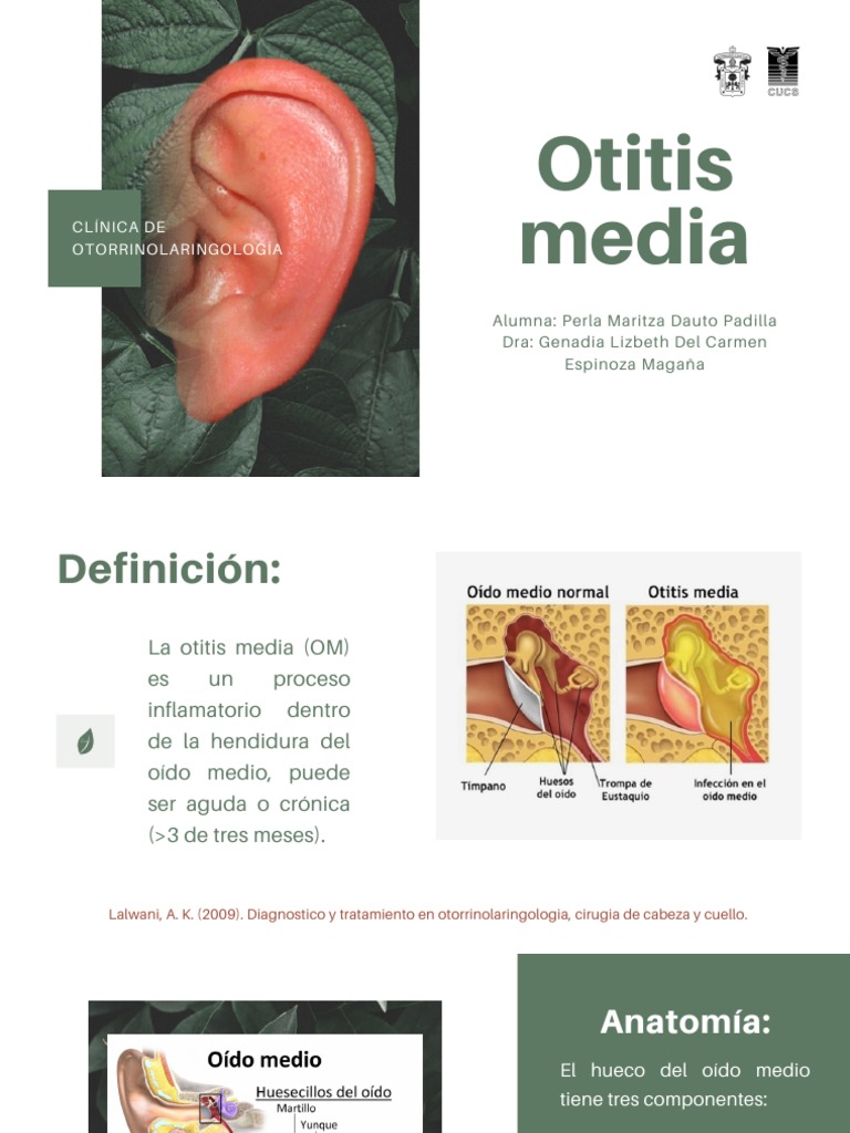 Otitis Media | PDF