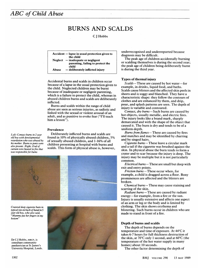 ABC of Child Abuse. Burns and Scalds. | PDF