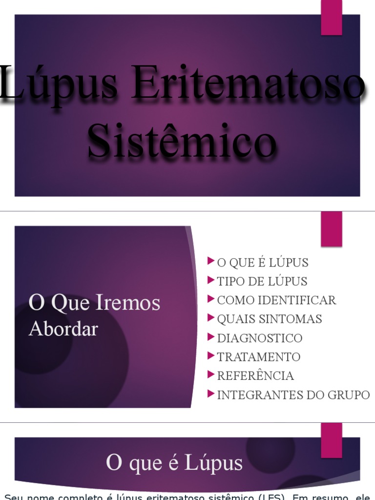 Lúpus Eritematoso Sistêmico | PDF