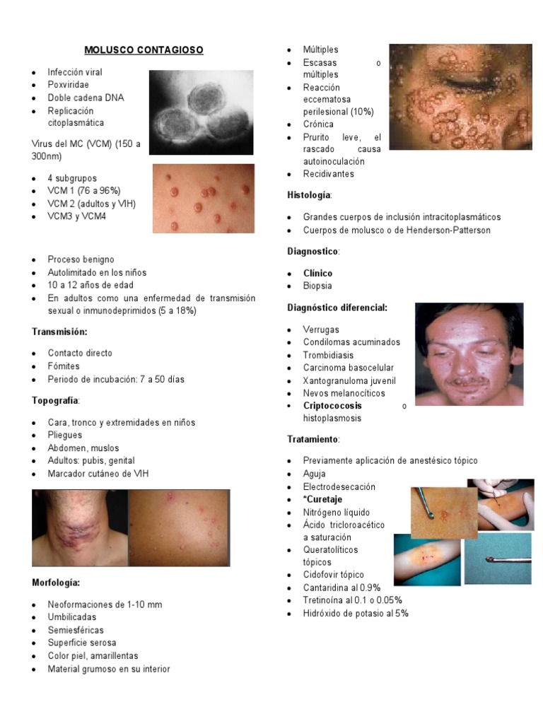 Molusco Contagioso: Guía Completa | PDF | Ciencia y matemáticas