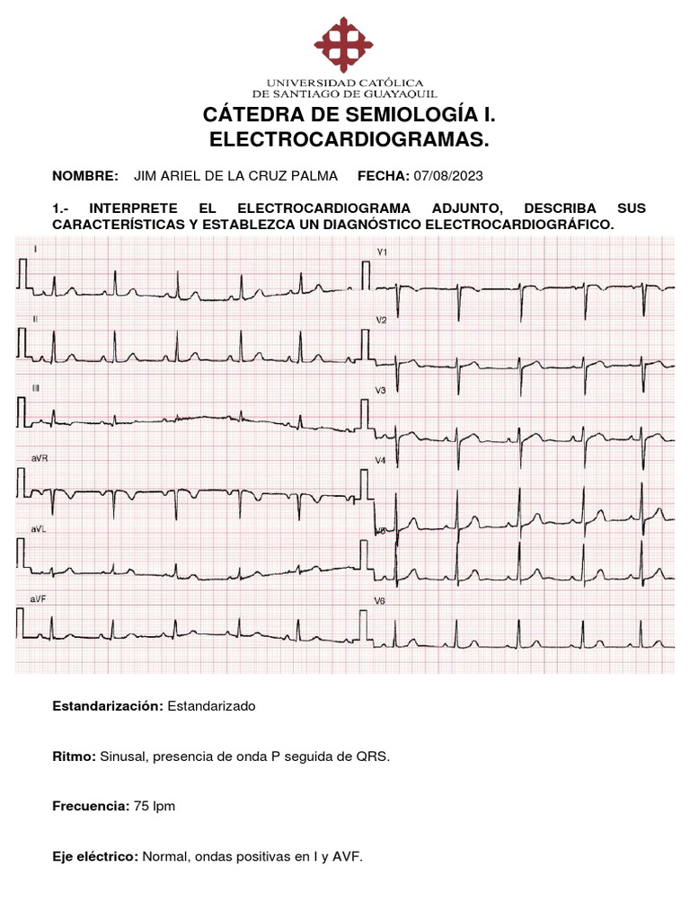 Tarea Ekg | PDF | Métodos y materiales de enseñanza | Ciencia y matemáticas
