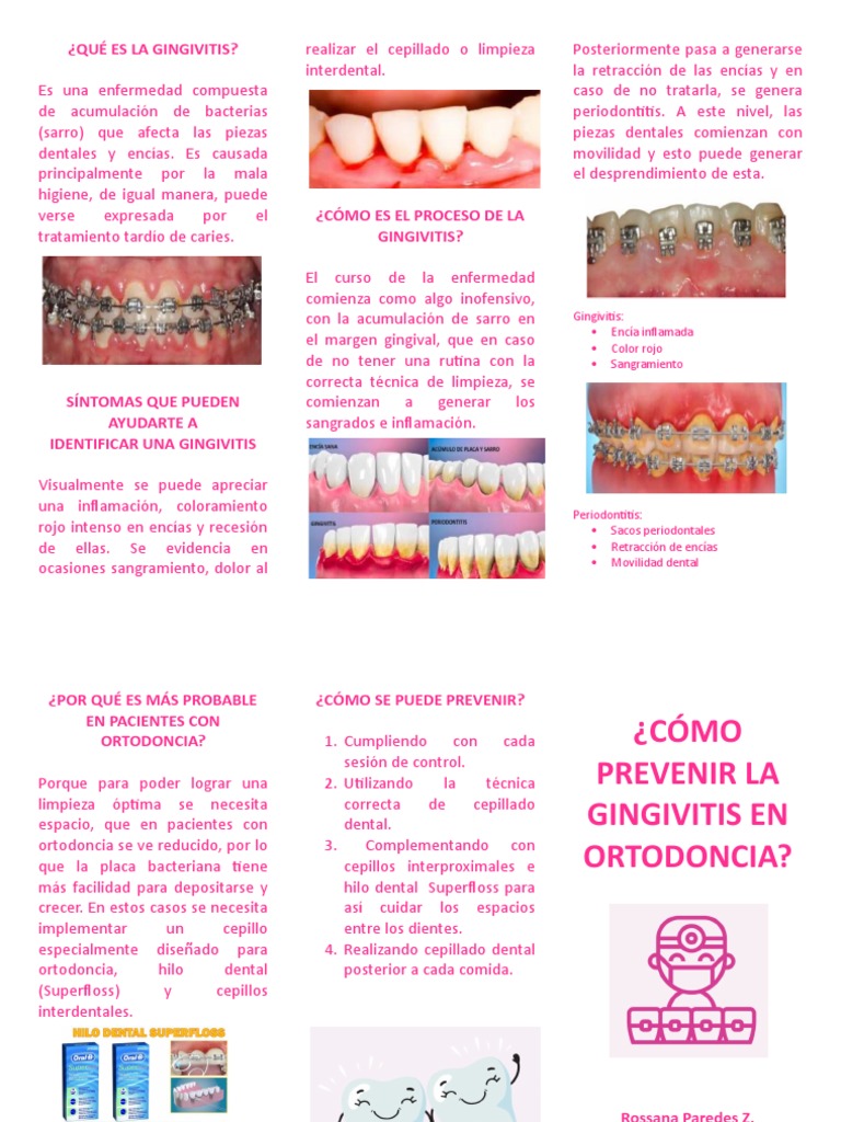 Que Es La Gingivitis en Ortodoncia | PDF