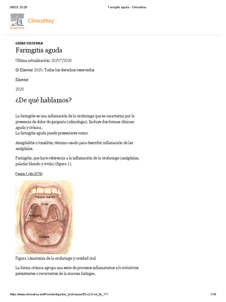 Faringitis Aguda - ClinicalKey | PDF
