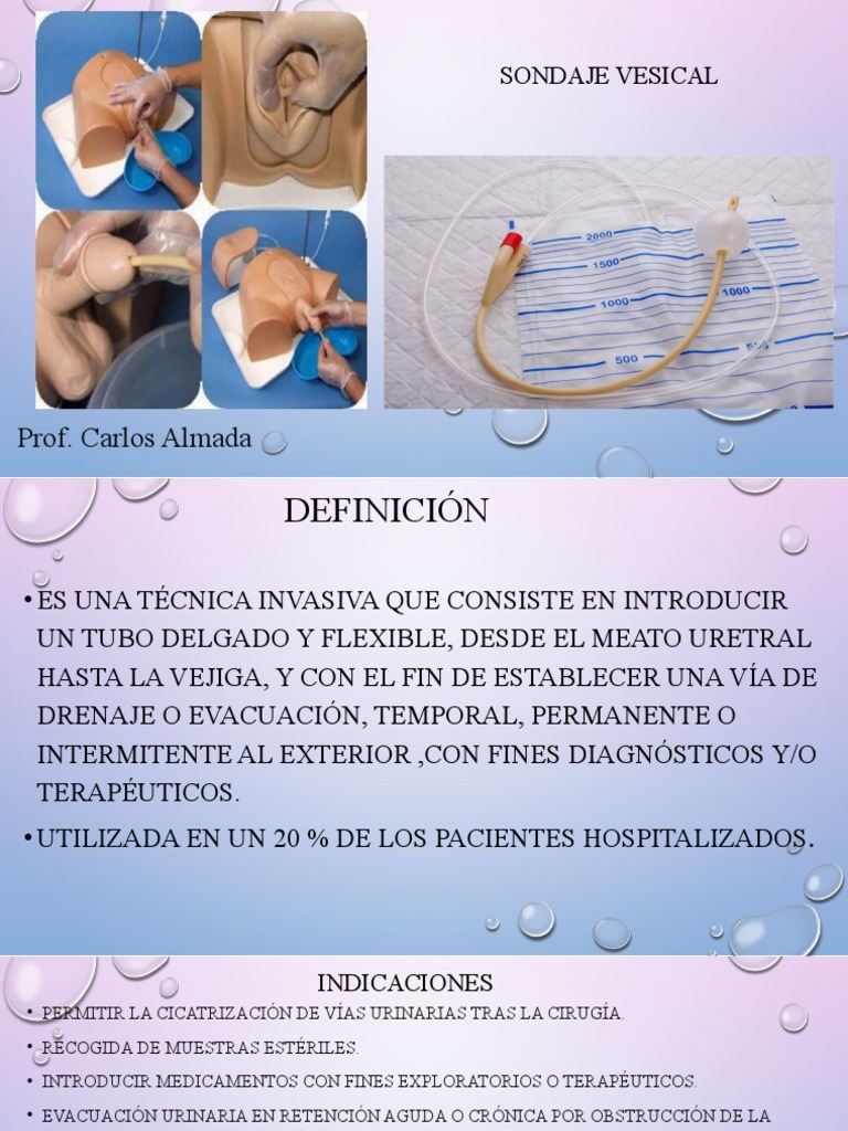 Guía Completa sobre Sondaje Vesical | PDF | Ciencia y matemáticas
