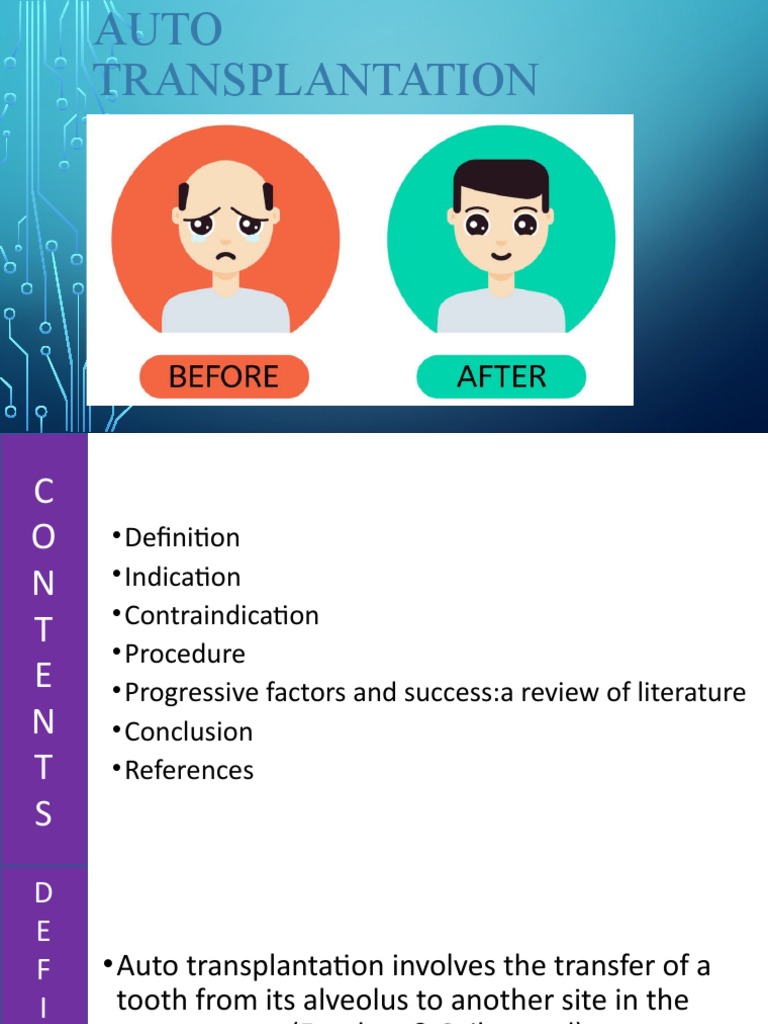 Autotransplantation | PDF