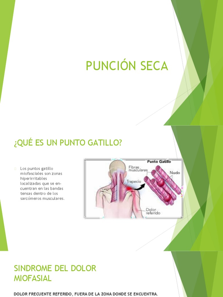 Punción Seca: Tratamiento de Puntos Gatillo | PDF