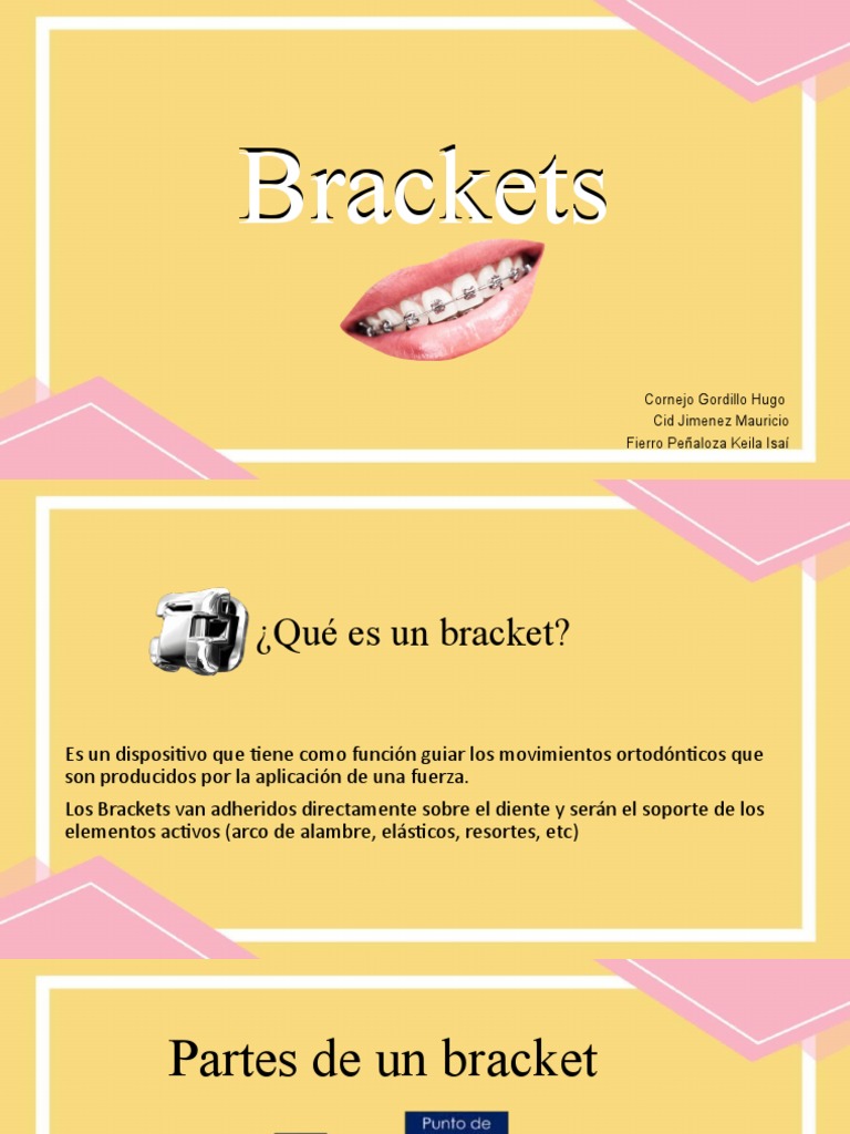 BRACKETS | PDF | Ortodoncia | Ramas de Odontología