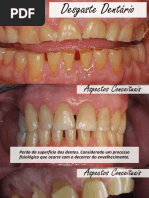 Modelo de Panfleto Editável (DST'S) Frente e Verso. Dobrar Ao Meio PPT ...