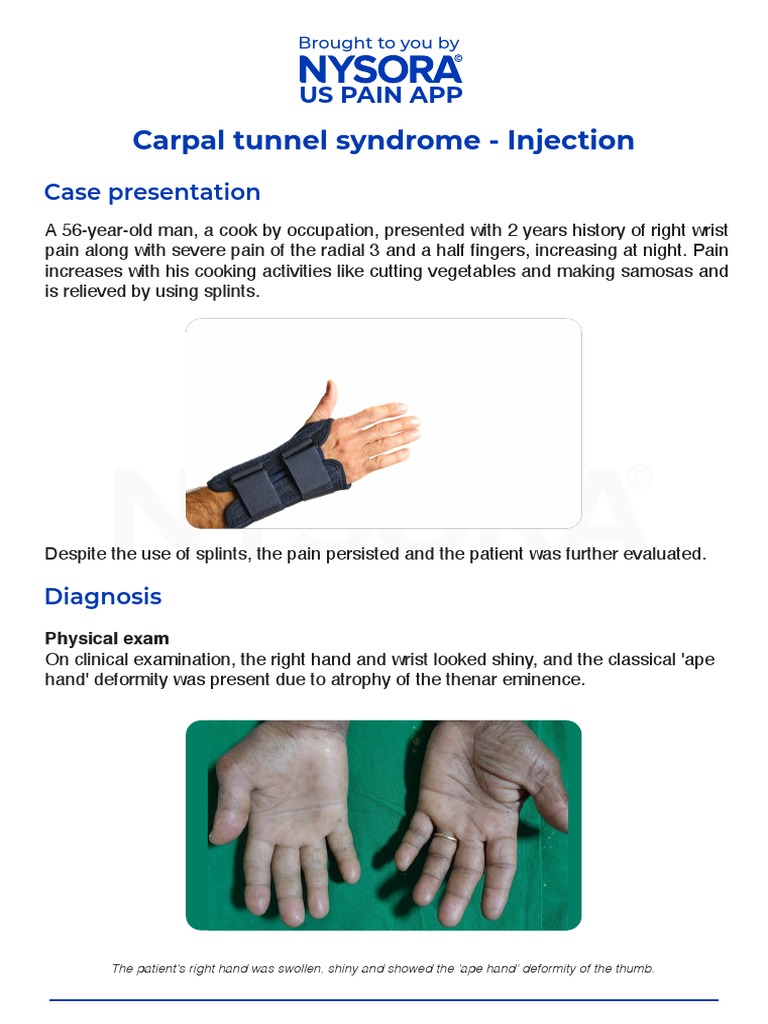 Carpal Tunnel Syndrome - Injection Case Study | PDF