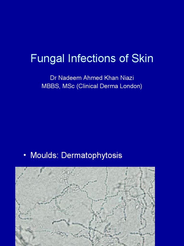 Fungal Infections of Skin | PDF | Candidiasis | Epidemiology