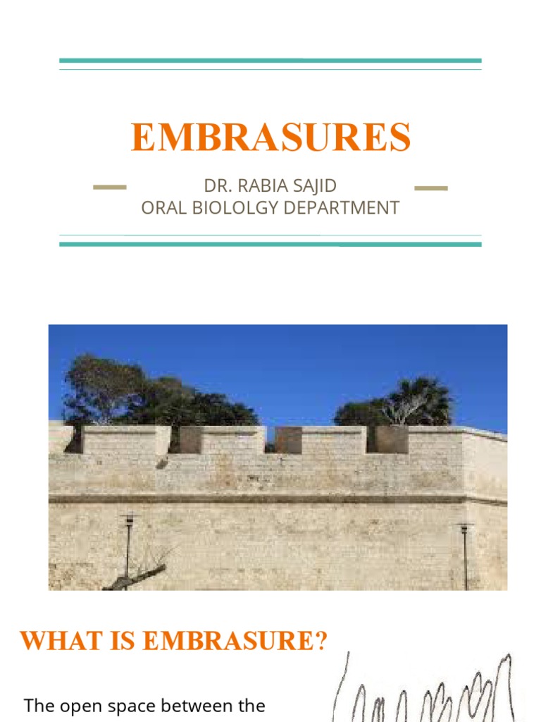 Embrasures | PDF