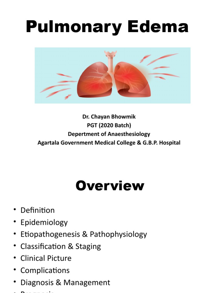 Pulmonary Edema PPT For Seminar | PDF