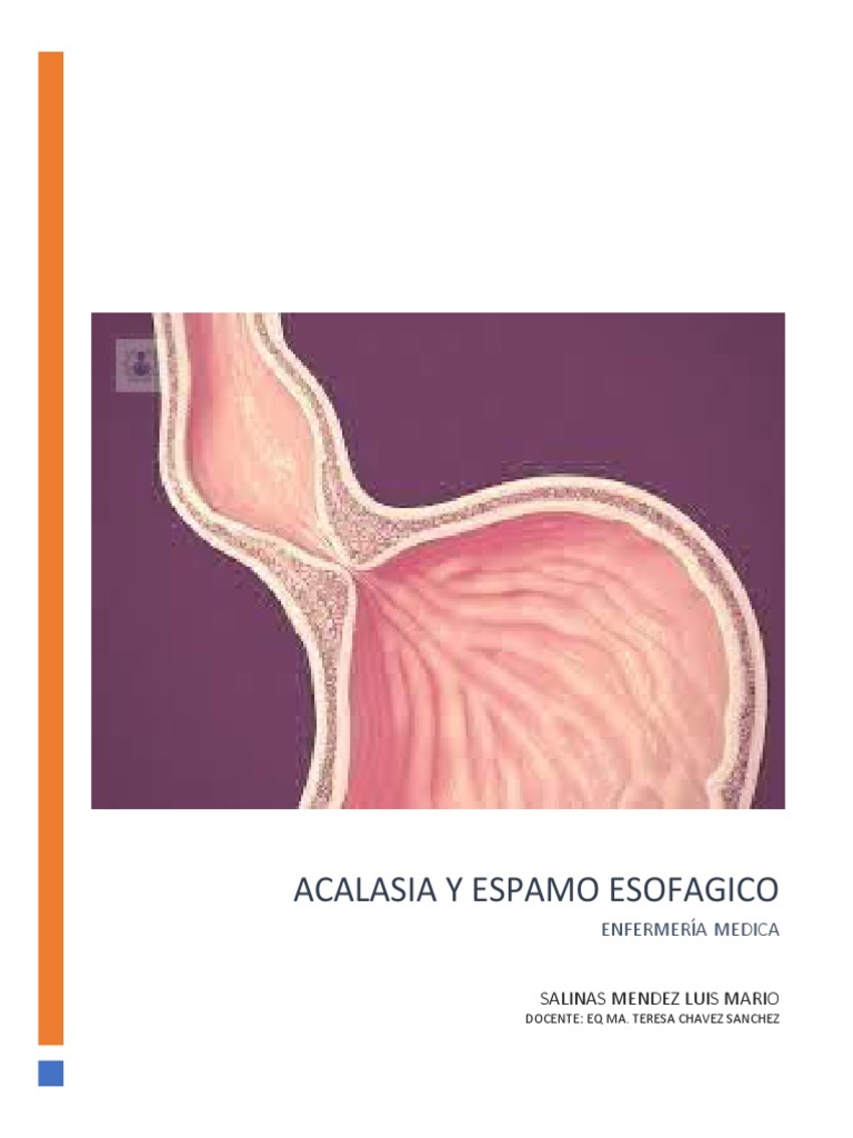 ACALASIA | PDF | Esófago | Medicina CLINICA
