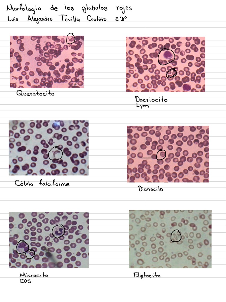 Morfologia de Los Globulos Rojos | PDF