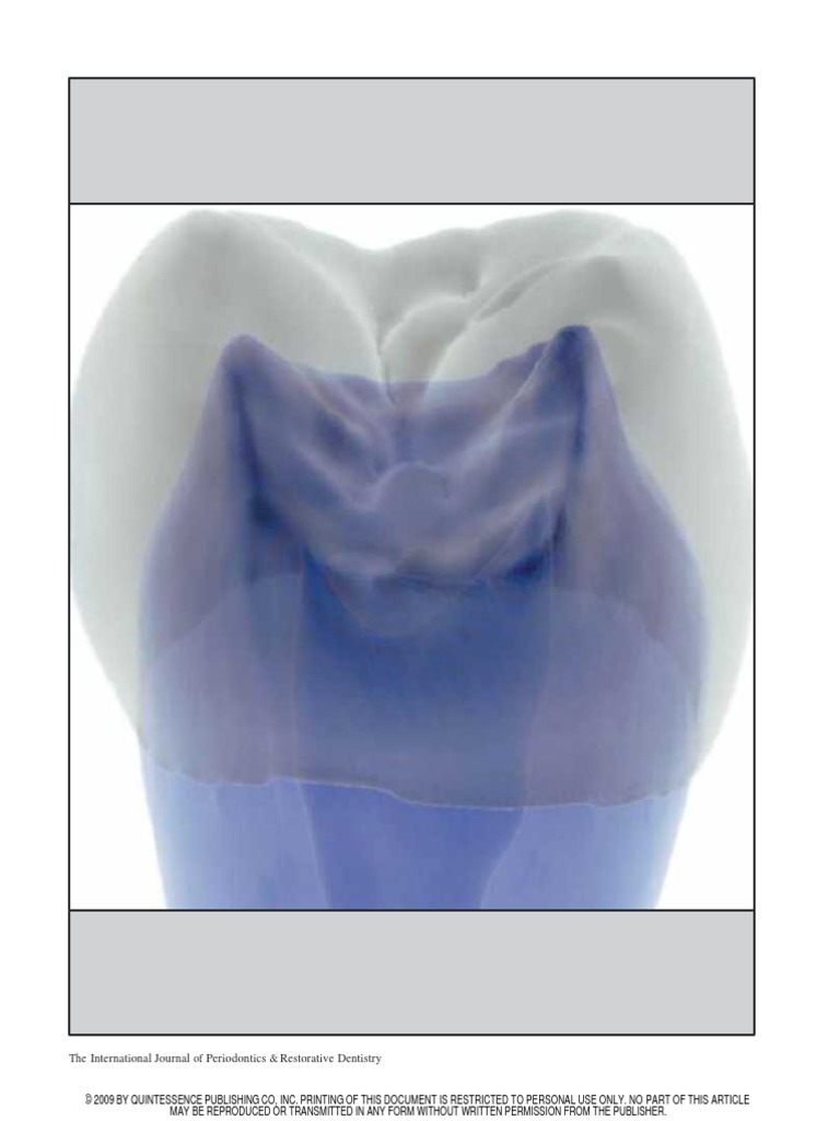 Magne 2009 CT Scan Based Finite Element Analysis of Premolar Cuspal | PDF