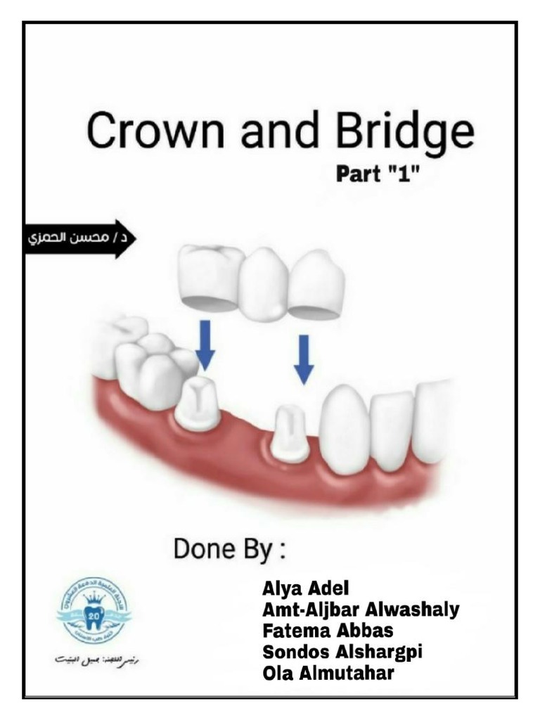 Crown and Bridge Prosthodontics Overview | PDF | Home & Garden