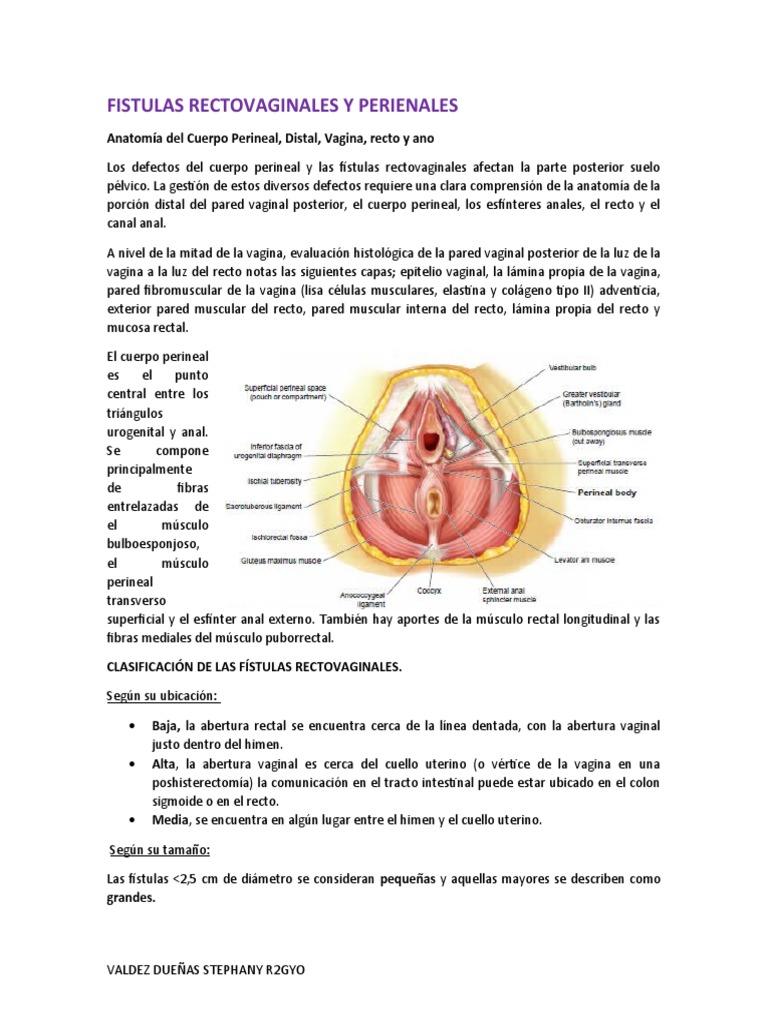 Fístulas Rectovaginales y Perineales | PDF | Recto | Vagina