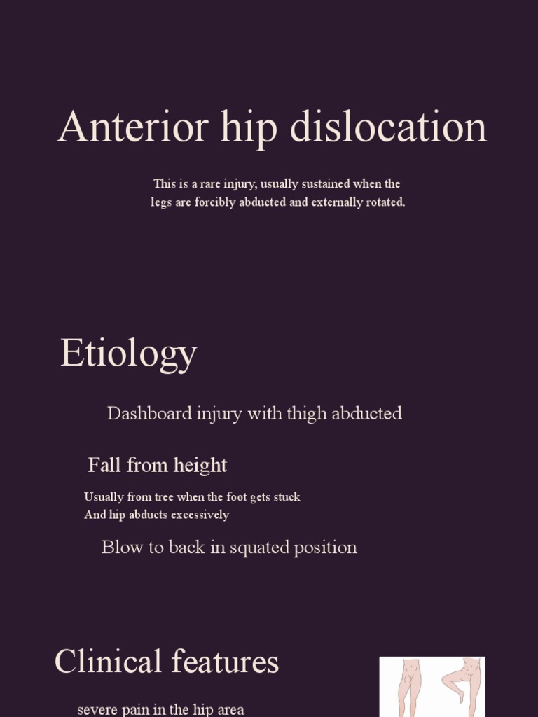 Anterior Hip Dislocation Overview | PDF | Science & Mathematics