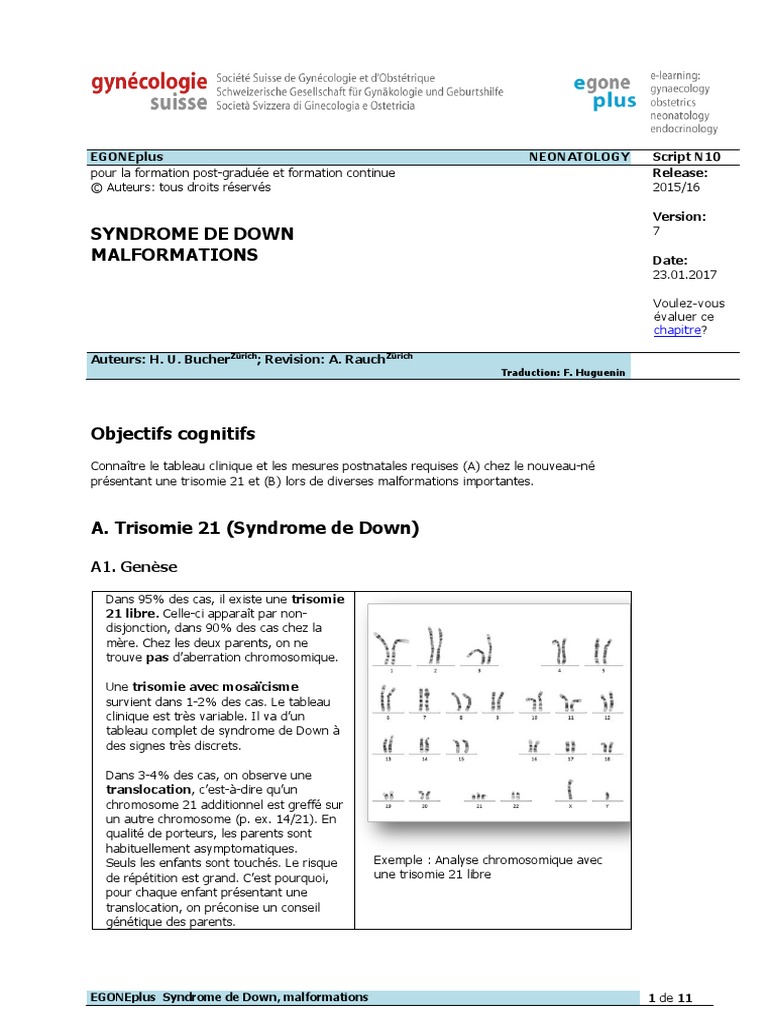 10 - Syndrome de Down | PDF