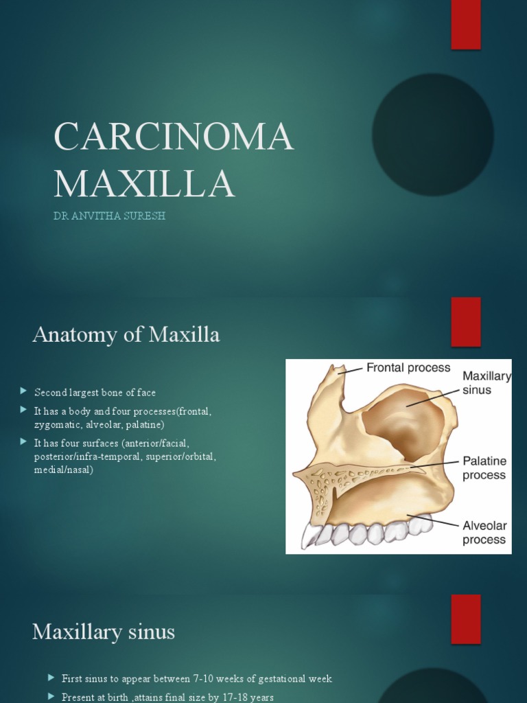 Carcinoma Maxilla | PDF | Human Nose | Causes Of Death