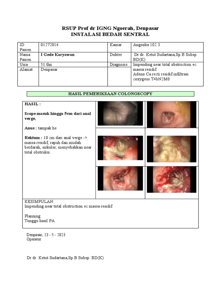 Hasil Kolonoskopi Pasien Kanker Rektum | PDF