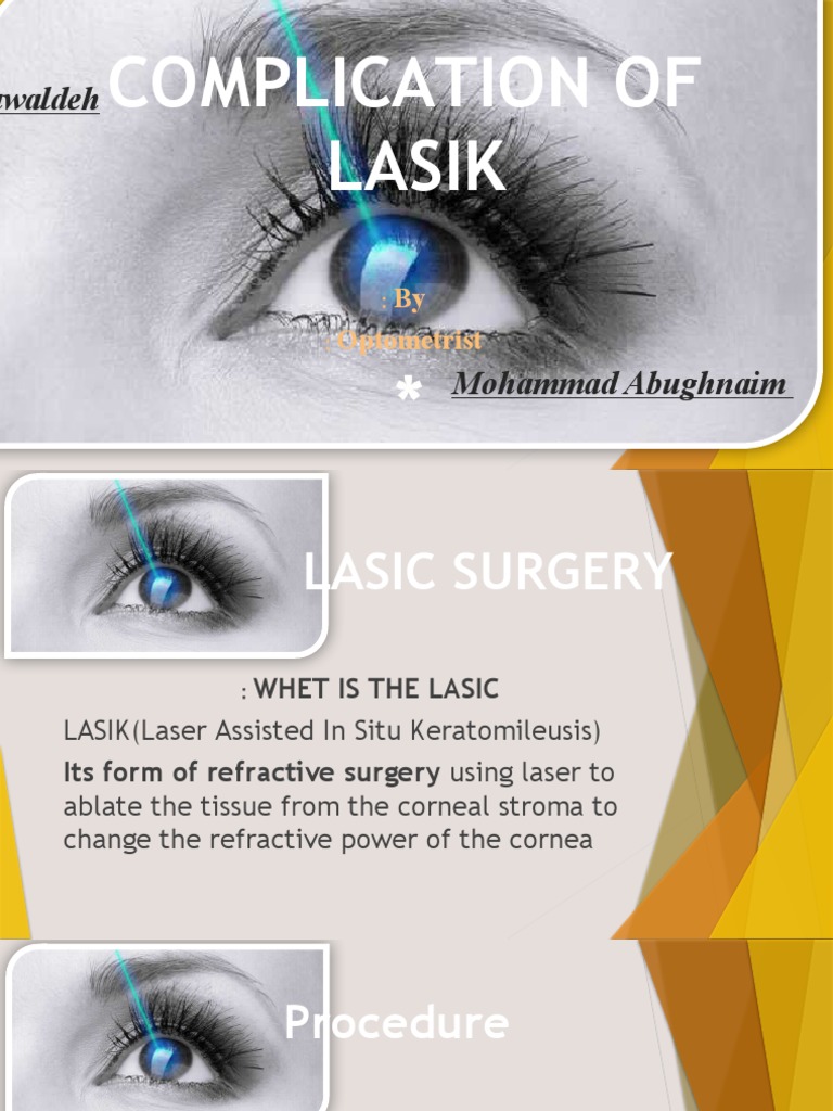 Lasik Complication | PDF | Science & Mathematics