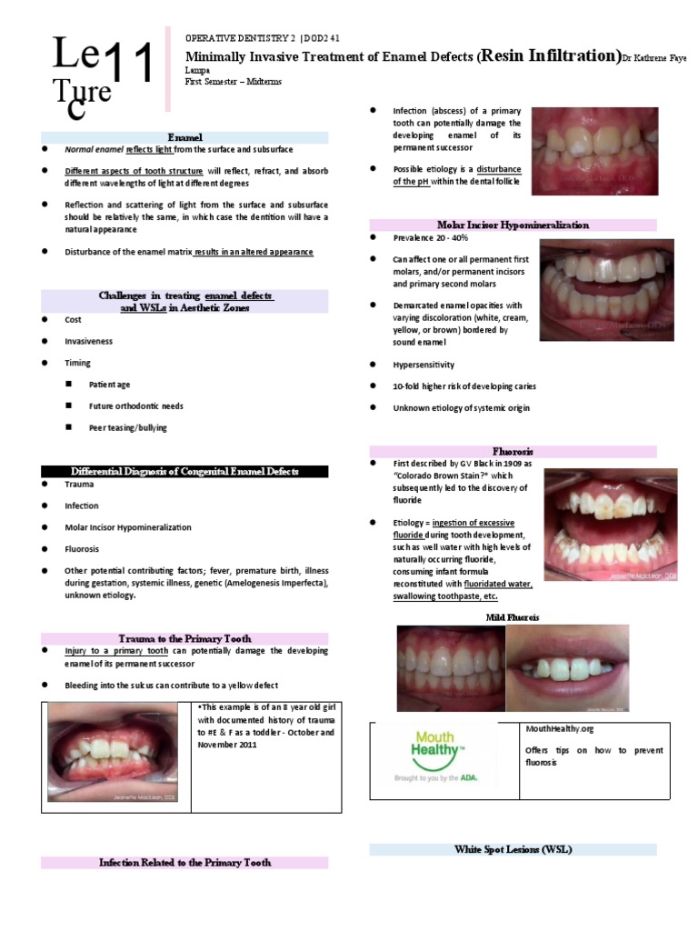 Anterior Resin Infiltration | PDF | Tooth Enamel | Health Care
