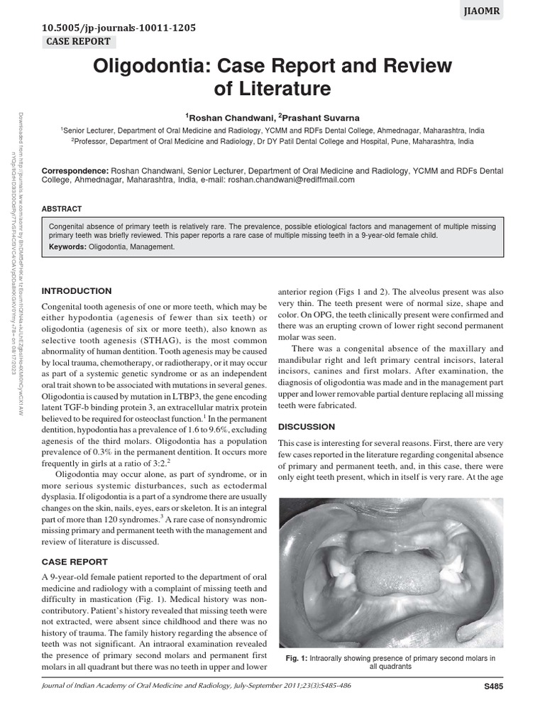 Oligodontia Case Study & Literature Review | PDF | Dentistry | Anatomy
