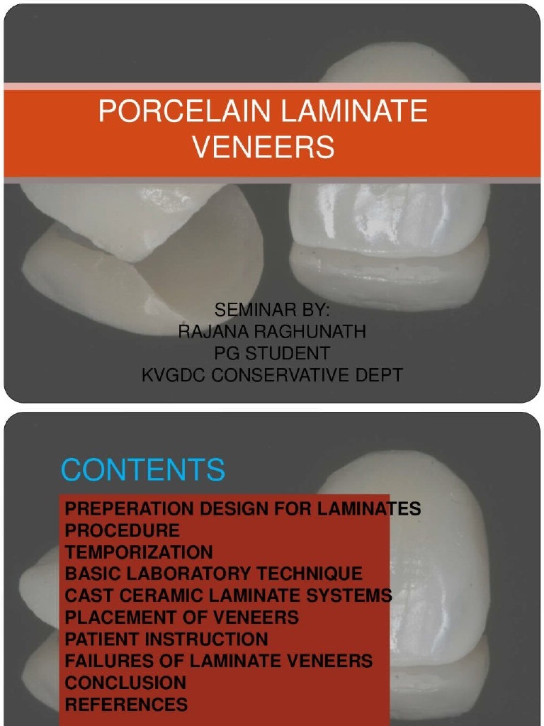 Porcelain Laminate Veneer | PDF