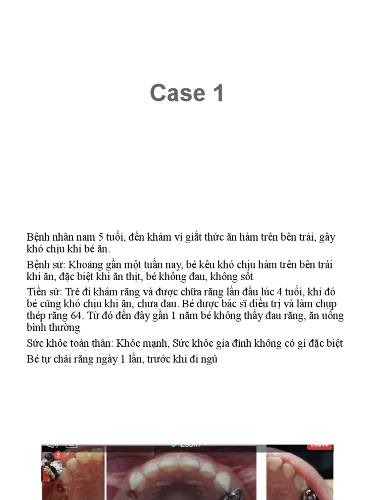 Case RTE | PDF