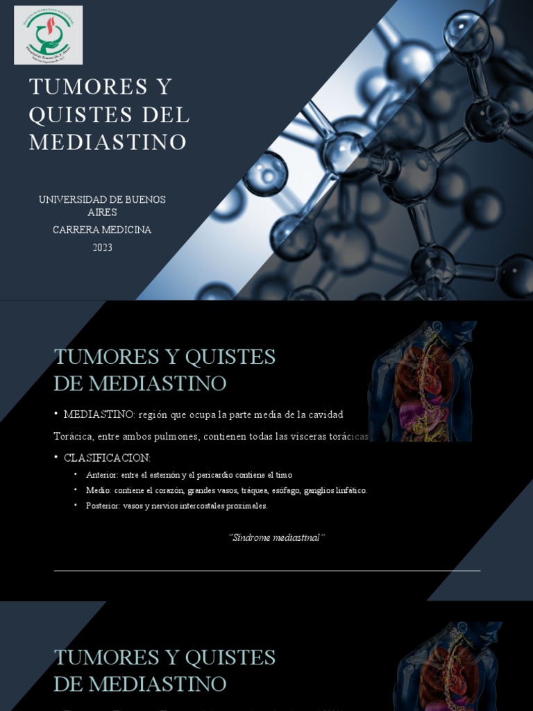 Tumor Mediastino | PDF