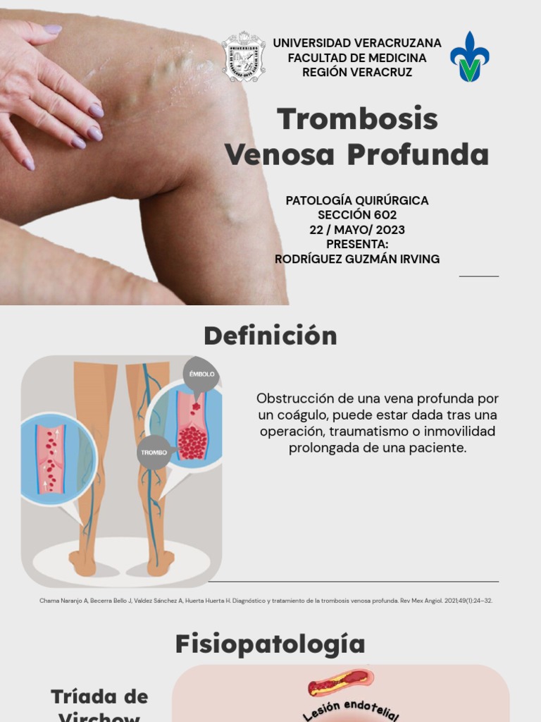 Trombosis Venosa Profunda | PDF
