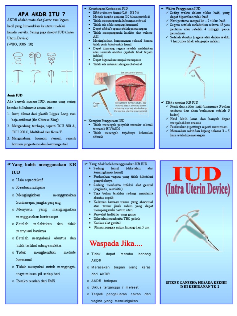 Leflet Iud Akbid | PDF