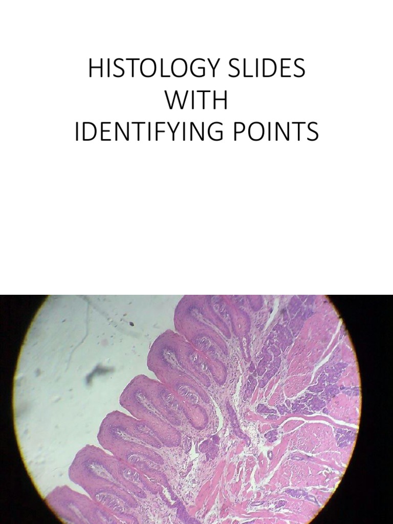 Histo Slides With Identifying Points | Download Free PDF | Lymph Node ...