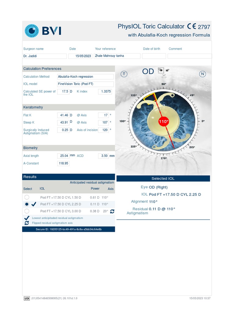 Toric Od | PDF | Face | Equipment