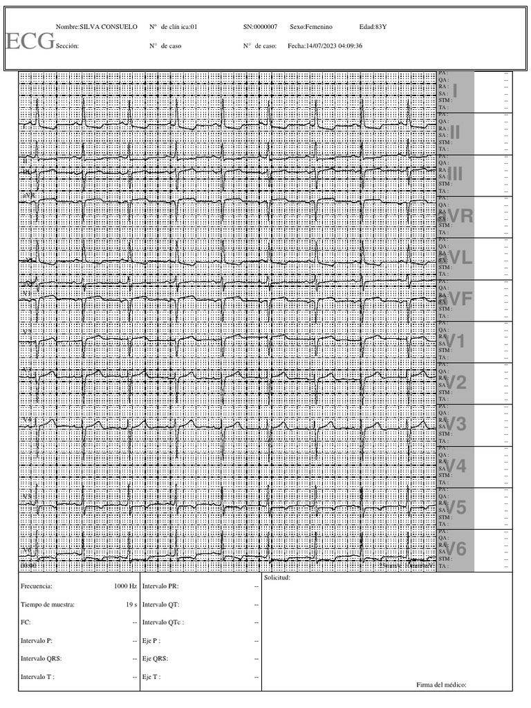 Ecg 2 | PDF