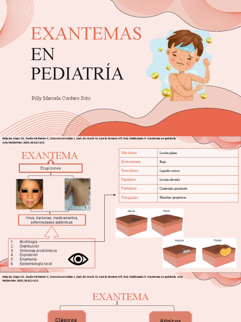 Exantemas en Pediatría | PDF