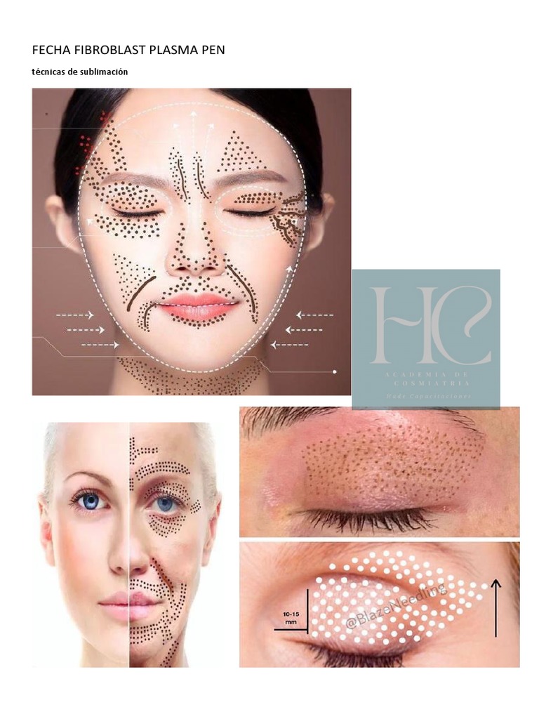 Ficha Fibroblast Plasma Pen | PDF