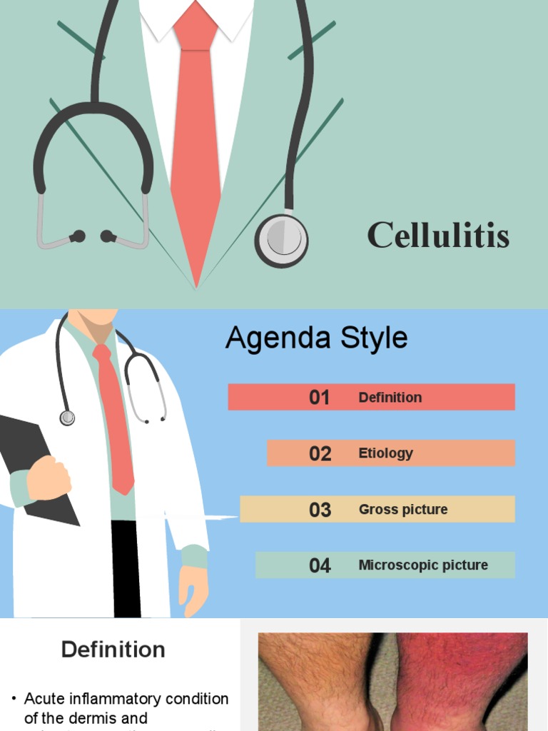 Overview of Cellulitis Pathology | PDF | Edema | Inflammation