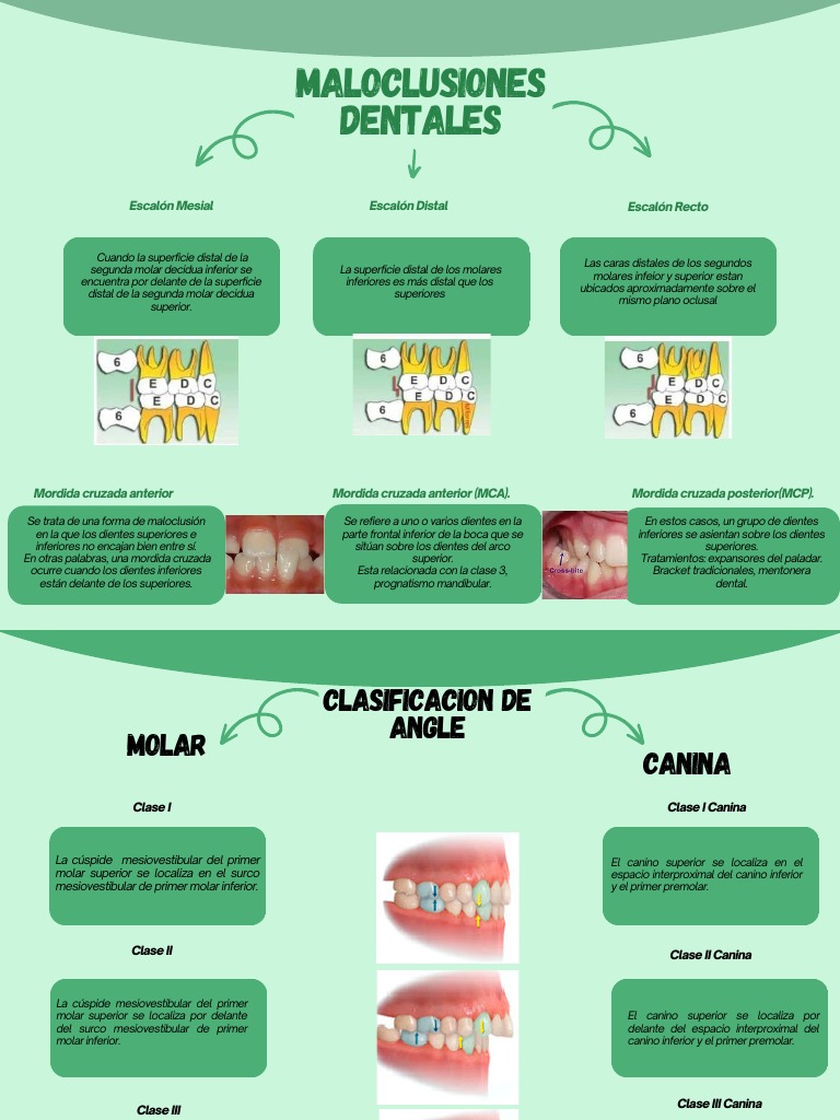 Clasificación de Maloclusiones según Angle | PDF | Diente | Anatomia animal