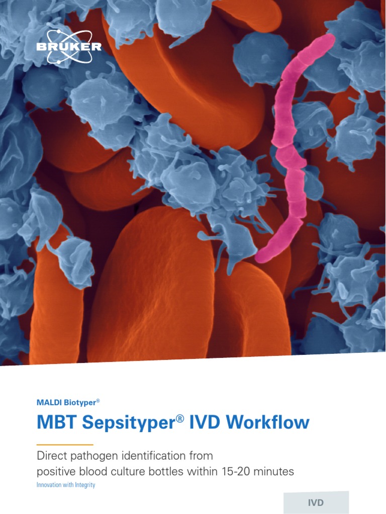 Read_more_about_MBT_Sepsityper_IVD_Workflow_1682516329 | PDF ...