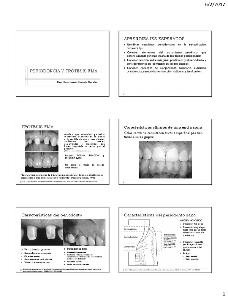 Periodoncia y PF 2017 | PDF