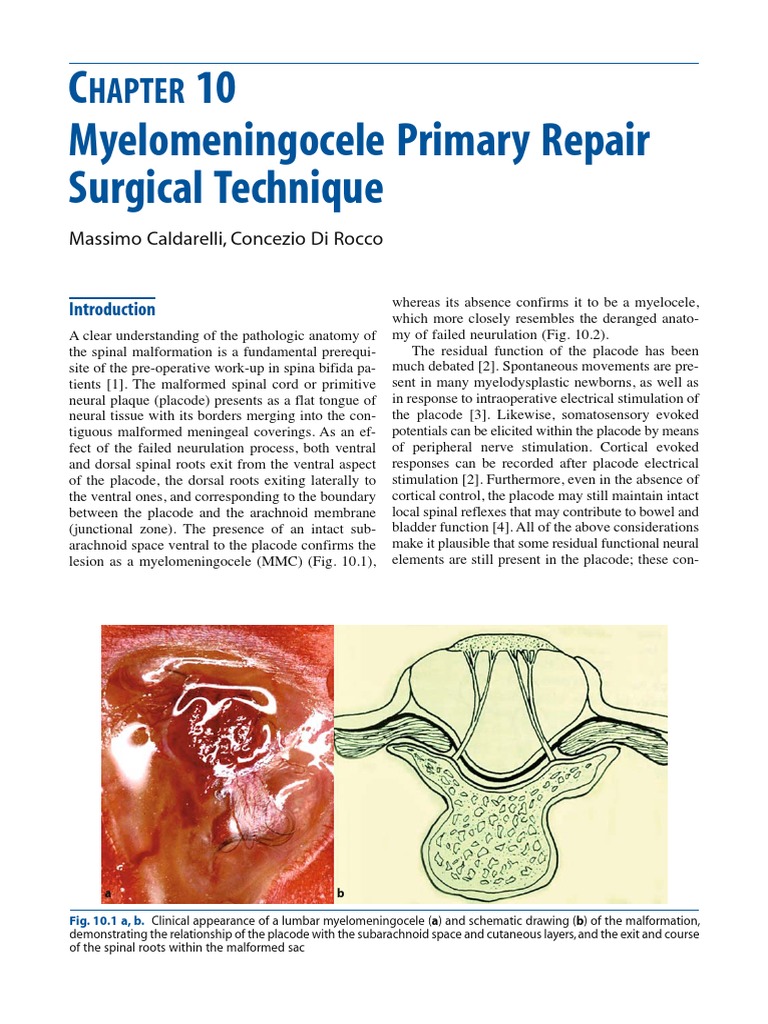 C 10 Myelomeningocele Primary Repair Surgical Technique: Hapter | PDF ...