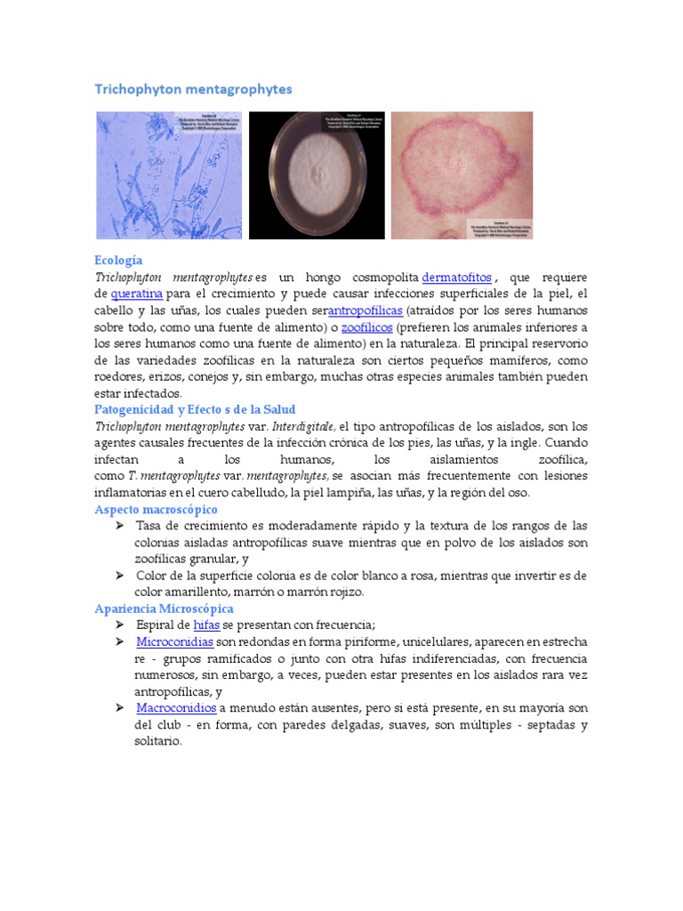 agentes etiologicos | Microbiología | Enfermedades y trastornos
