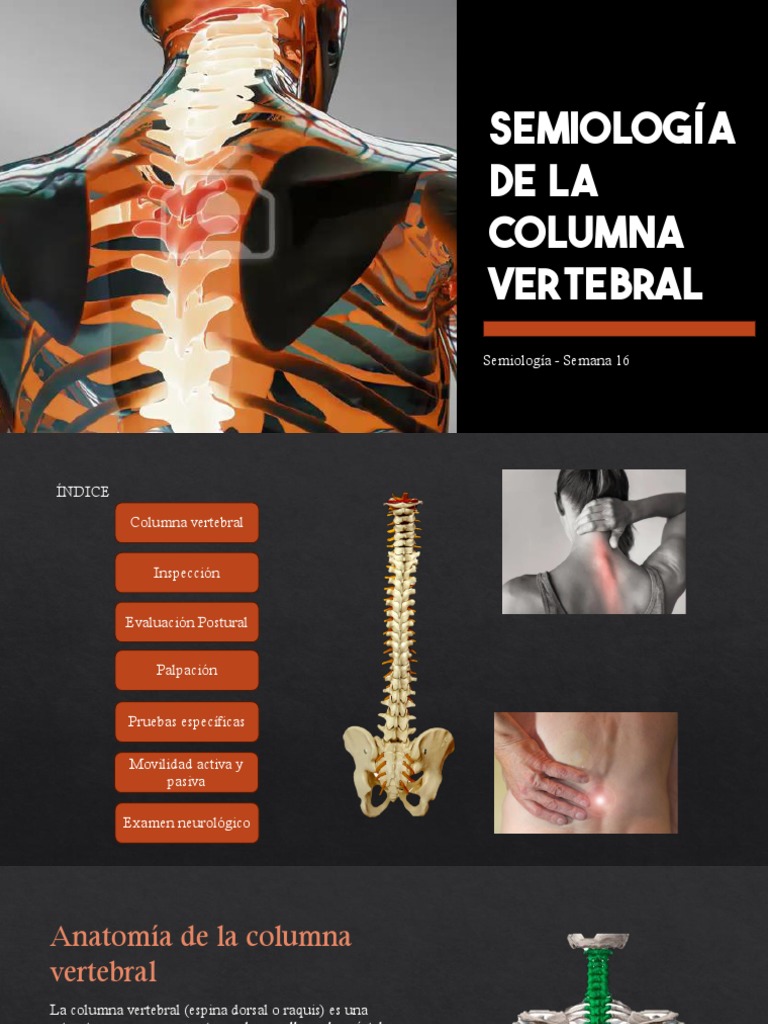 Semiología de la Columna Vertebral | PDF | La columna vertebral | Vértebra