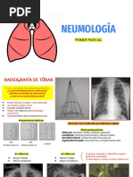 Radiografía de Tórax Normal - Patrón Intersticial | PDF | Pulmón | Tórax