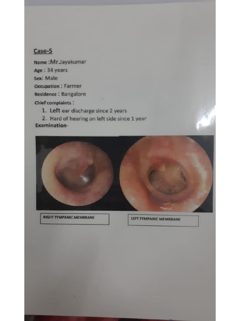 Ent Clinical Cases | PDF