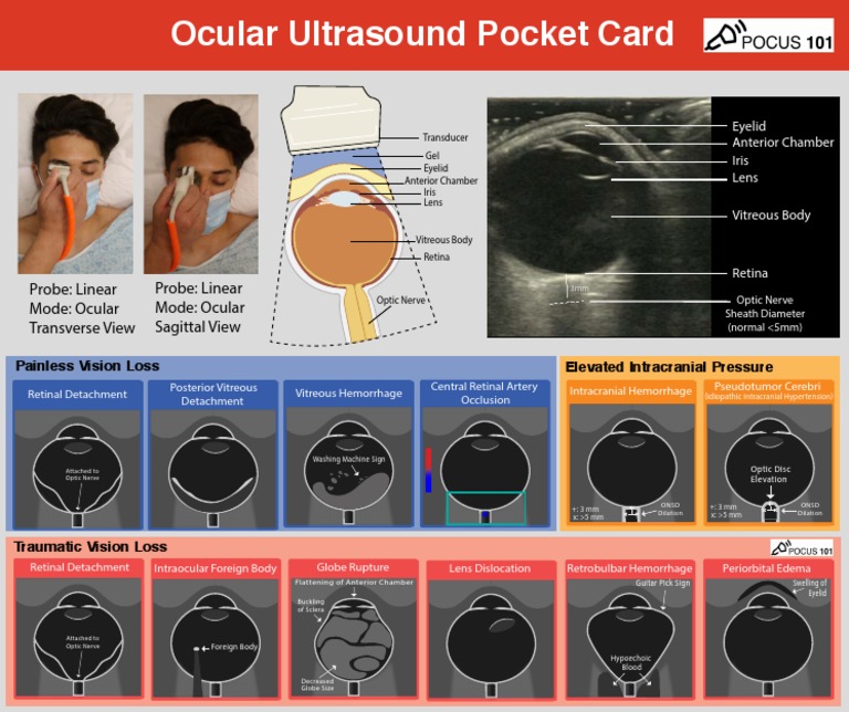 POCUS 101 Ocular Ultrasound Pocket Card | PDF | Human Eye | Clinical ...