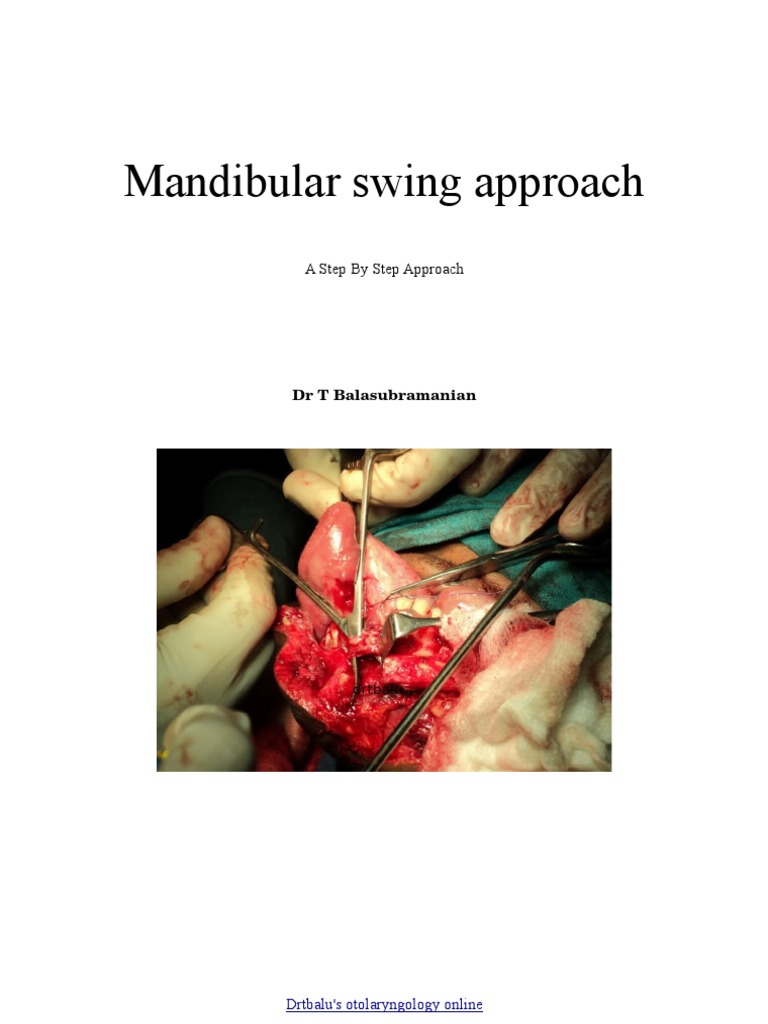 Mandibular Swing | PDF | Surgery | Human Anatomy